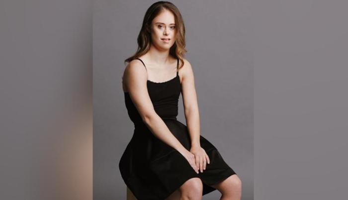Chelsea Werner, la modelo con sindrome de Down que rompe paradigmas