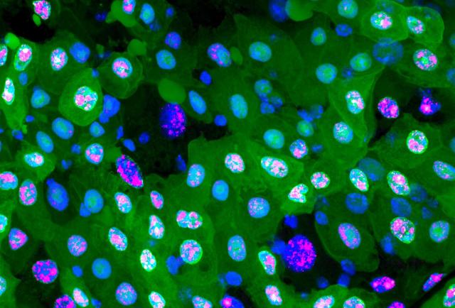 Descubren un tipo de muerte celular desconocido en los intestinos de la ...